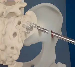 Tyler Ptacek, MD — Interventional Pain Physician | Rapid City, SD